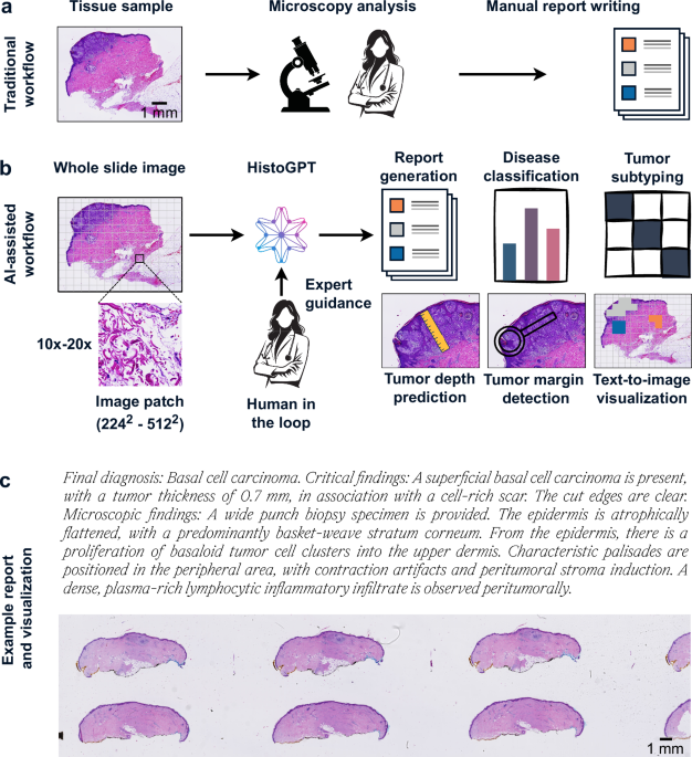 Generating dermatopathology reports from gigapixel whole slide images ...