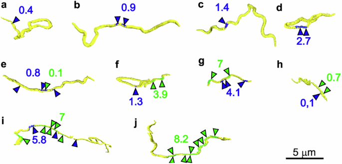 Targeted volume imaging reveals early vascular interactions of Lyme ...