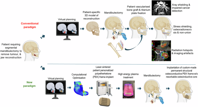 Mechanobiologically-optimized non-resorbable artificial bone for ...