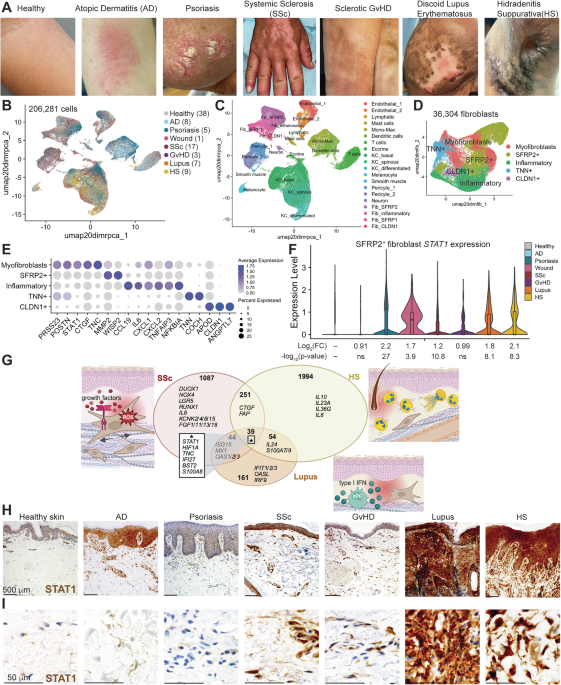 EGFR-STAT1 pathway drives fibrosis initiation in fibroinflammatory skin ...