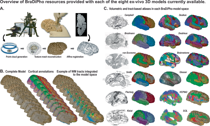 Brain dissection photogrammetry: a tool for studying human white matter ...