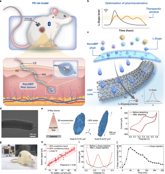 A nanoMIP sensor for real-time in vivo monitoring of levodopa ...