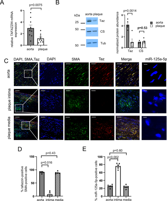 Defective vascular smooth muscle cell tafazzin impairs mitochondrial ...