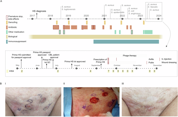 Prolonged disease remission of the chronic immunological skin disorder ...
