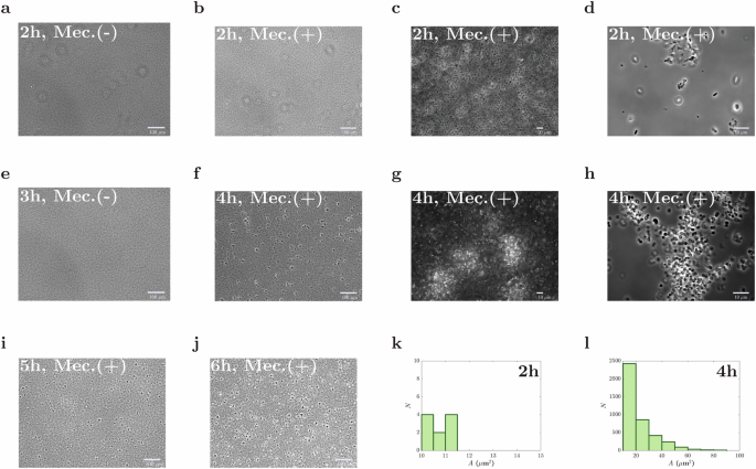 Bacterial aggregation triggered by low-level antibiotic-mediated lysis ...