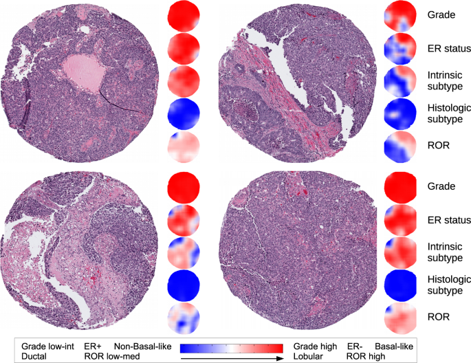 Image analysis with deep learning to predict breast cancer grade, ER ...