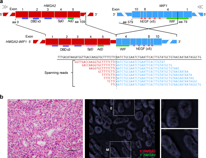 Assessment of HMGA2 and PLAG1 rearrangements in breast ...