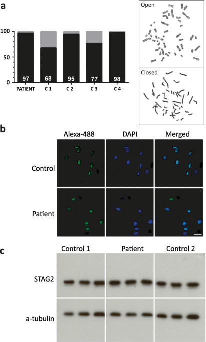 Familial STAG2 germline mutation defines a new human cohesinopathy ...