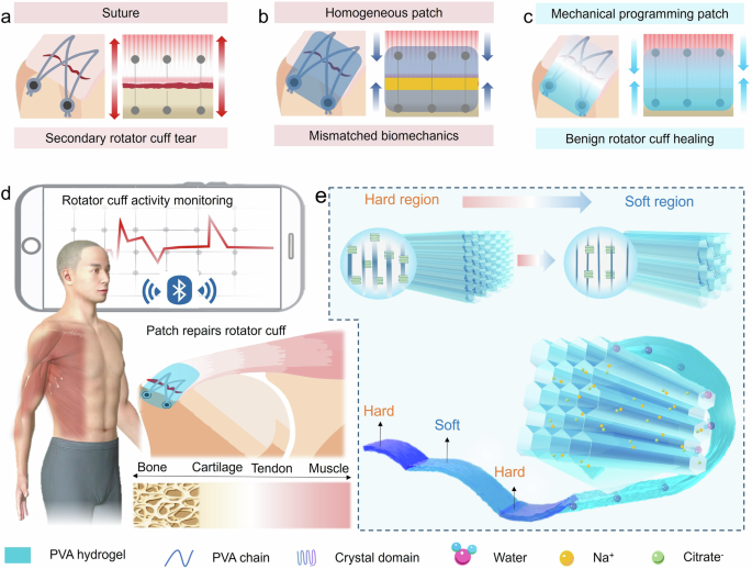 High-strength mechanically gradient hydrogels via physical crosslinking ...