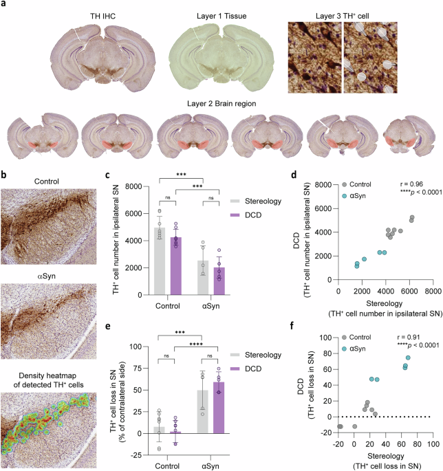 Development of convolutional neural networks for automated brain-wide histopathological analysis ...
