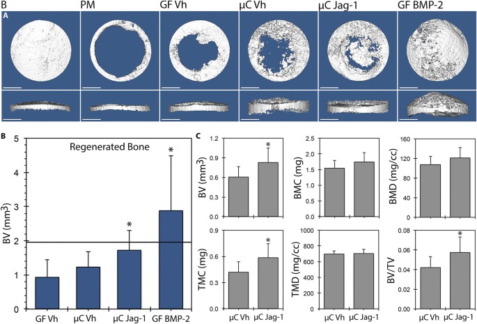 Intraoperative delivery of the Notch ligand Jagged-1 regenerates ...