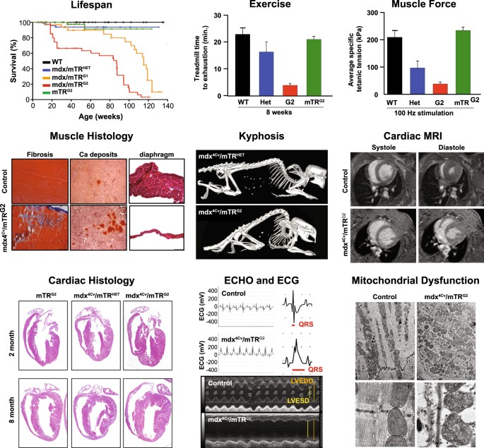 Humanizing the mdx mouse model of DMD: the long and the short of it ...