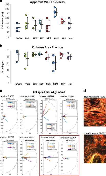 Variable outcomes of human heart attack recapitulated in genetically ...
