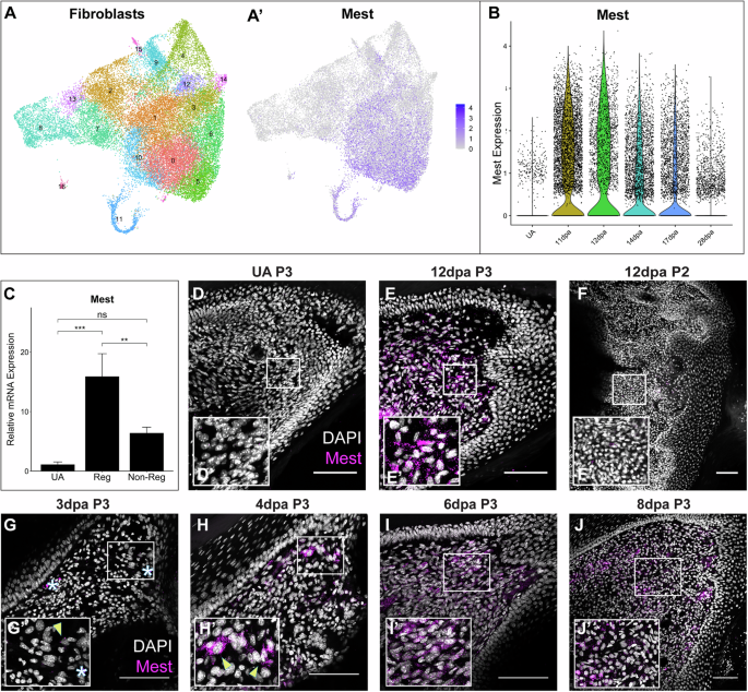 Regeneration-specific promoter switching facilitates Mest expression in ...