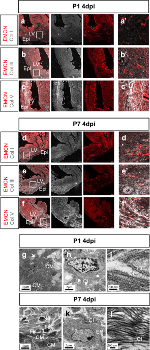 Type V collagen from macrophages regulates initial collagen assembly ...