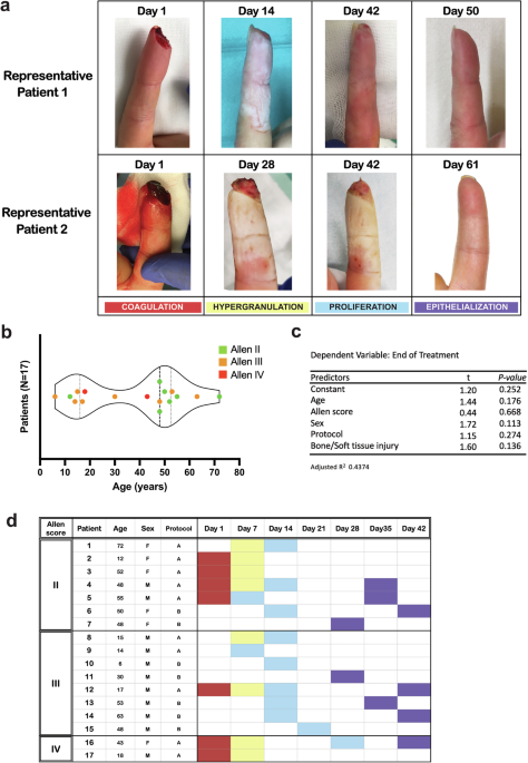 Human fingertip regeneration follows clinical phases with distinct ...