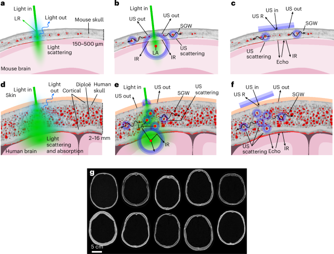 Imaging the brain by traversing the skull with light and sound | Nature ...