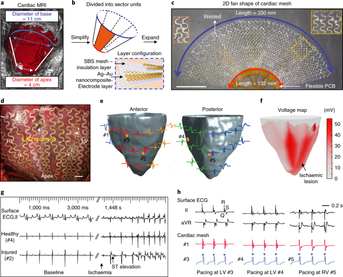 Highly conductive, stretchable and biocompatible Ag–Au core–sheath ...