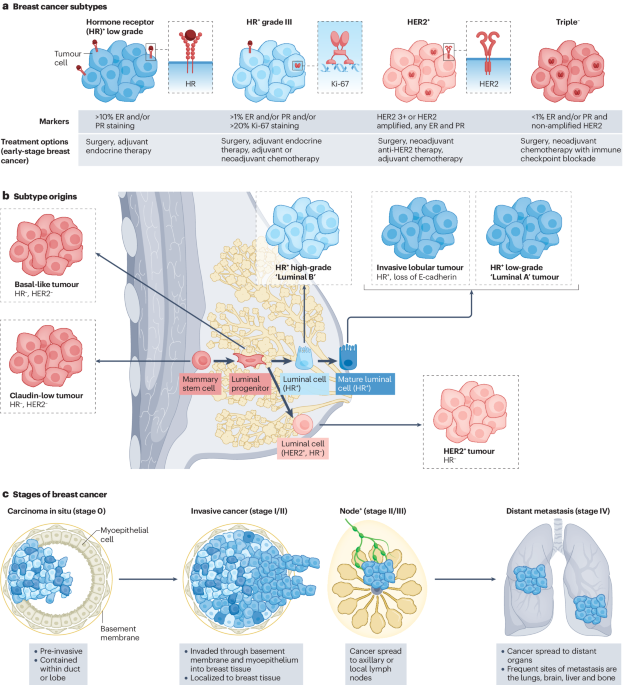 Towards targeting the breast cancer immune microenvironment | Nature ...
