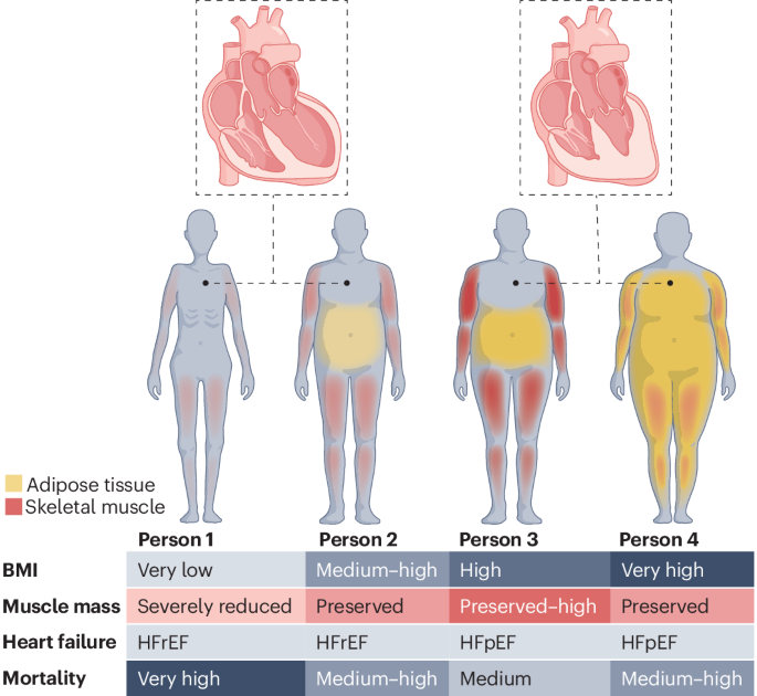 Redefining heart failure subtypes according to skeletal muscle mass ...