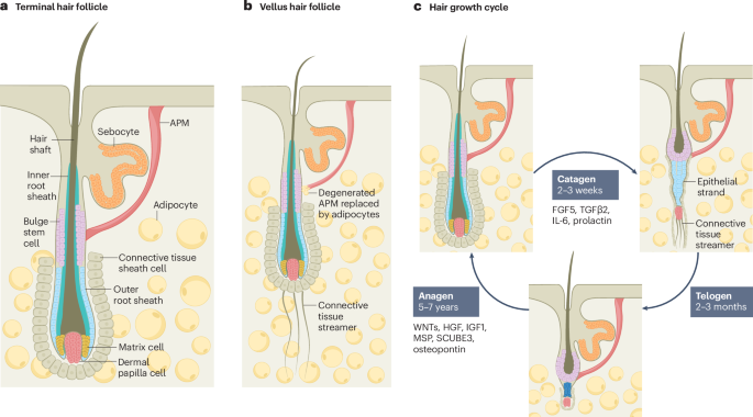 Androgenetic alopecia | Nature Reviews Disease Primers