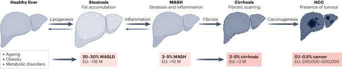 A roadmap for clinical trials in MASH-related compensated cirrhosis ...