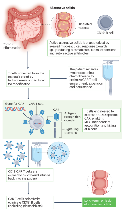 Rethinking B cells in ulcerative colitis: a CAR T cell opportunity ...