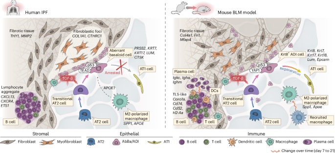Mapping the lung fibrosis transcriptome of mice and men | Nature Genetics