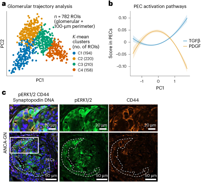 Glomerular cross-talk in the progression of autoimmune kidney disease ...