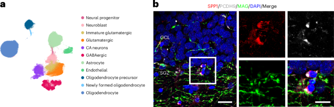 A cellular reference atlas across human brain regions | Nature Medicine