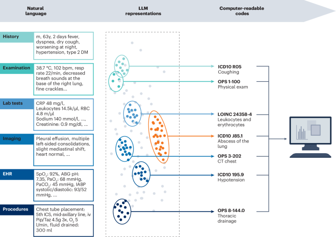 Large language models could make natural language again the universal ...