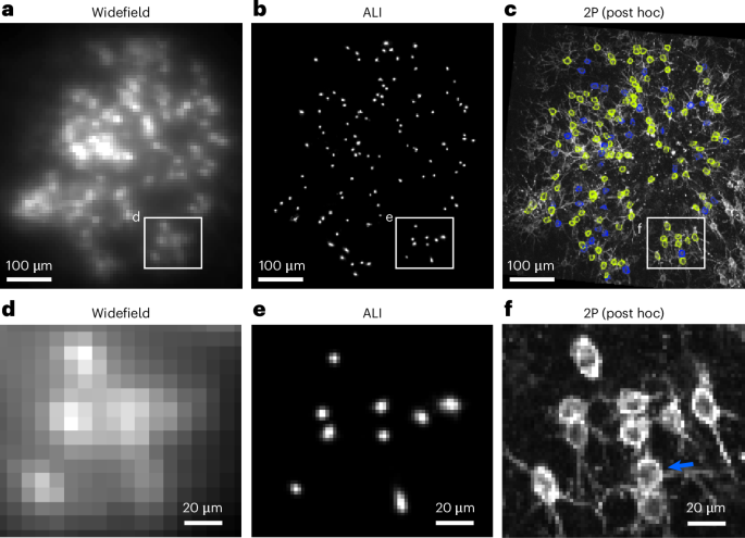 Super-resolution imaging technique for precision in vivo neuronal ...