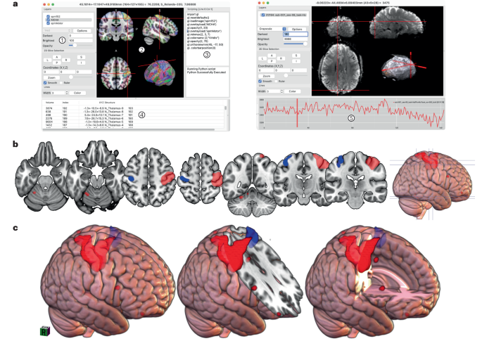 MRIcroGL: voxel-based visualization for neuroimaging | Nature Methods