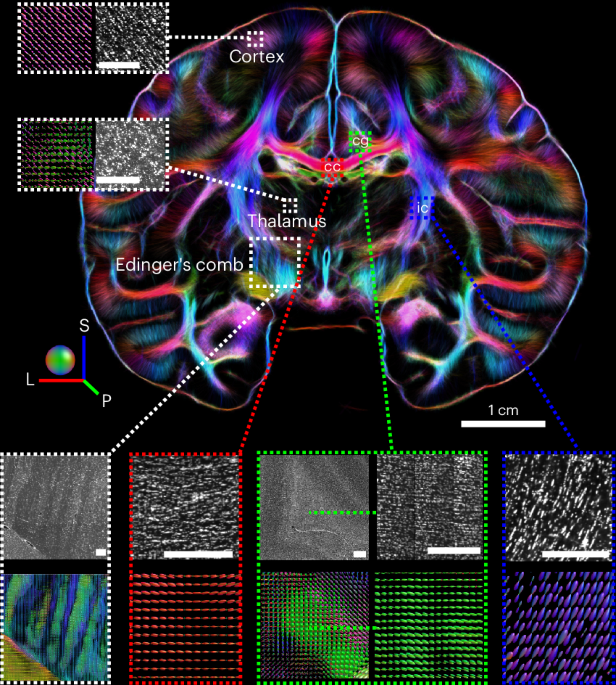 High-resolution brain mapping with cytoarchitecture-based link ...