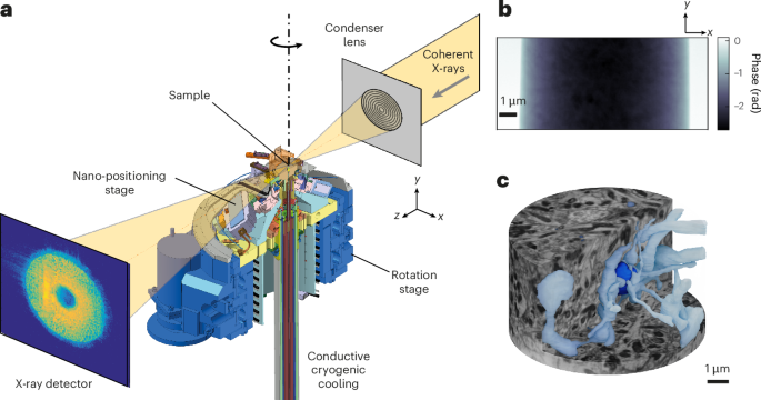 Unlocking the potential of X-rays to scale up tissue ultrastructure ...