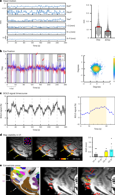 Multiple loci for foveolar vision in macaque monkey visual cortex ...