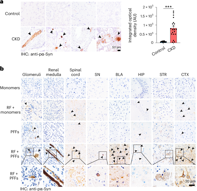 α-Synuclein deposition in the kidney may contribute to Parkinson’s disease | Nature Neuroscience