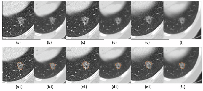 Annotated test-retest dataset of lung cancer CT scan images ...