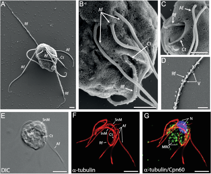 The expanded genome of Hexamita inflata, a free-living diplomonad ...