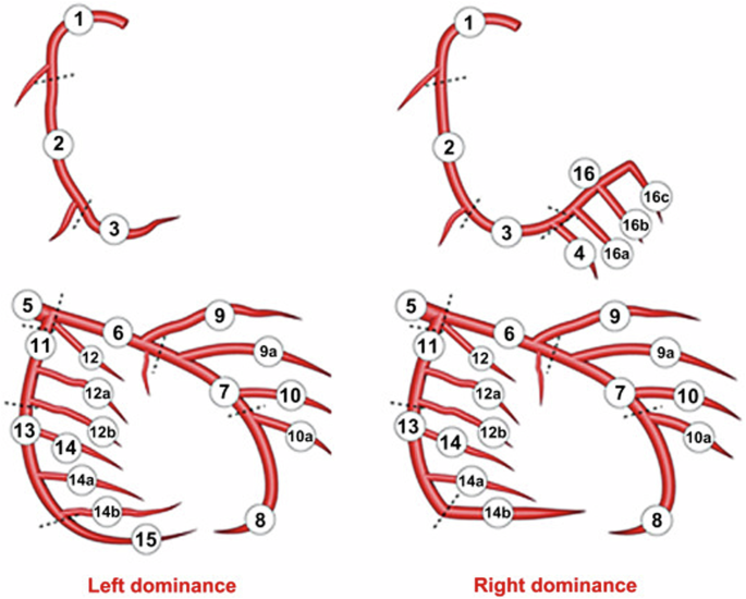 X-ray Coronary Angiogram images and SYNTAX score to develop Machine ...