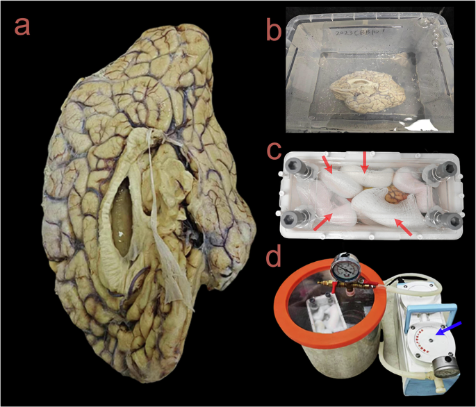 7 Tesla multimodal MRI dataset of ex-vivo human brain | Scientific Data
