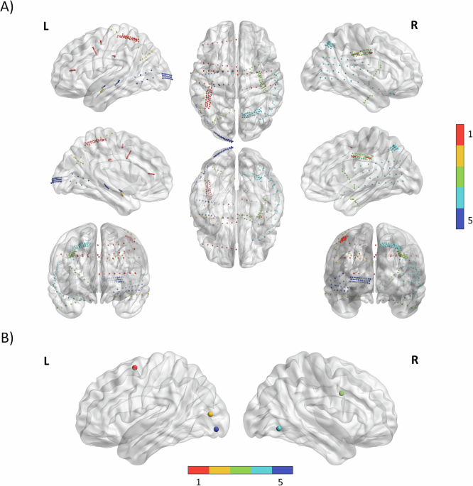 Mesoscale insights in Epileptic Networks: A Multimodal Intracranial ...