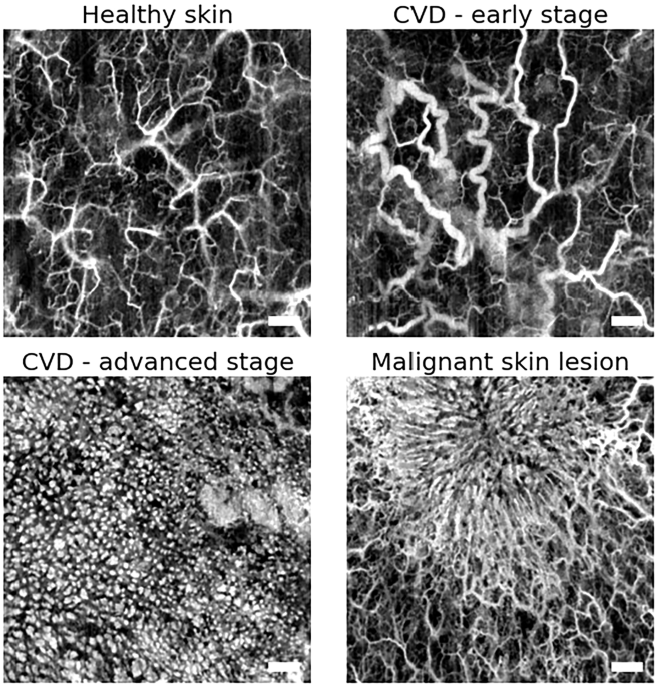DERMA-OCTA: A Comprehensive Dataset and Preprocessing Pipeline for ...