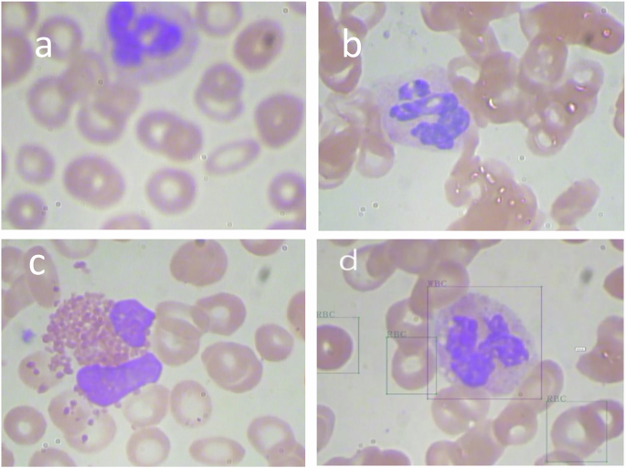 A Curated and Re-annotated Peripheral Blood Cell Dataset Integrating ...
