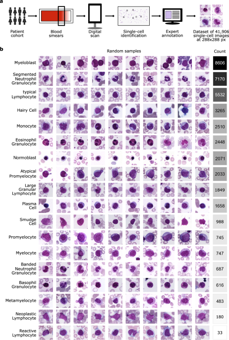A large expert-annotated single-cell peripheral blood dataset for ...