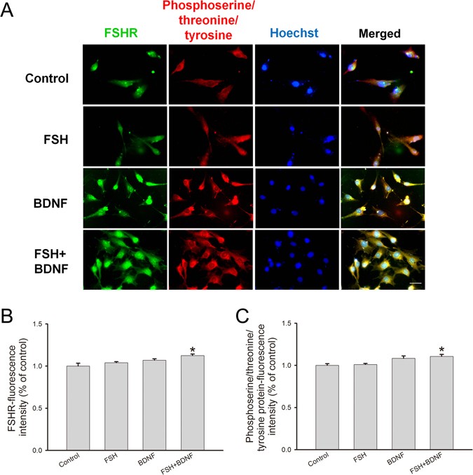 Brain-derived neurotrophic factor promotes human granulosa-like tumor ...