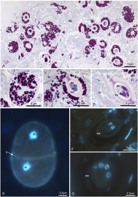 First record of gregarines (Apicomplexa) in seminal vesicle of insect ...