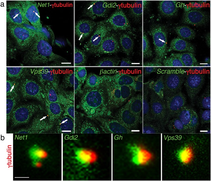 The centrosomal OFD1 protein interacts with the translation machinery ...