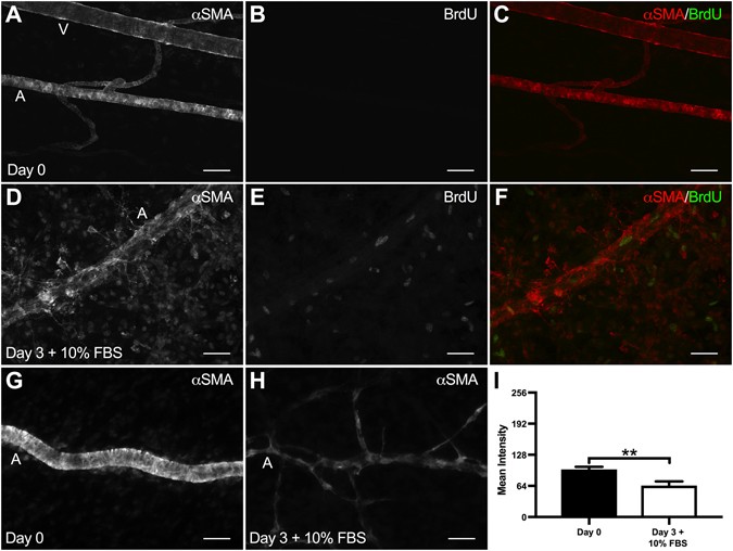Evaluation of Arteriolar Smooth Muscle Cell Function in an Ex Vivo ...