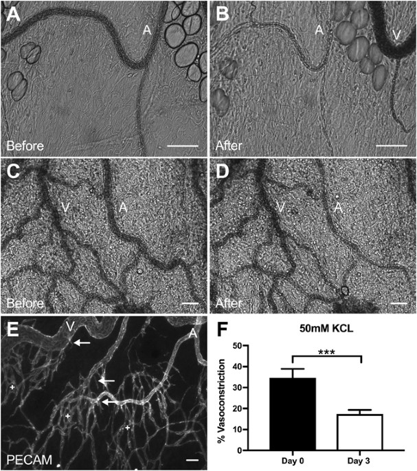 Evaluation of Arteriolar Smooth Muscle Cell Function in an Ex Vivo ...